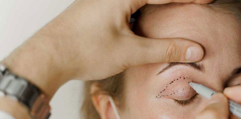 Eyelid Tuck (Blepharoplasty) vs. Brow Lift: Which One is Right for You ...